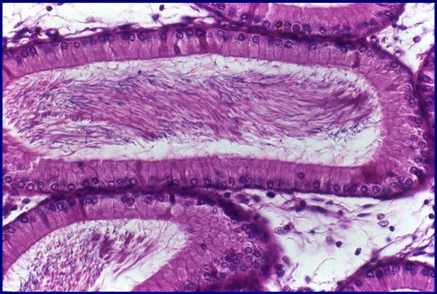 Histología: Epidídimo