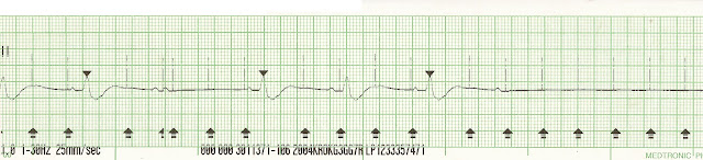 Electrical Interventions