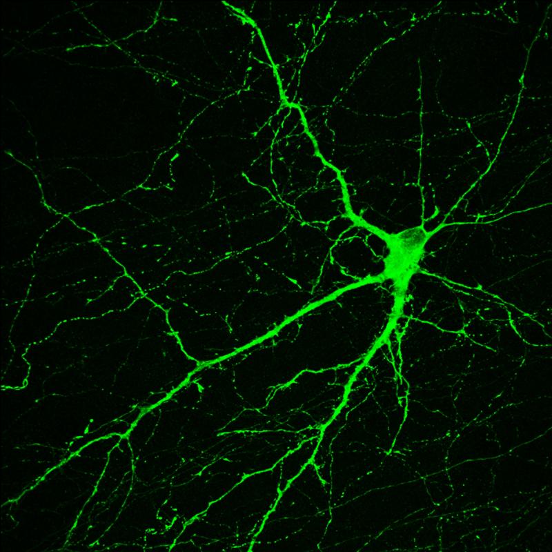 Suburban spaceman: Fluorescent Neural Cells from Monkey Skin Mature ...