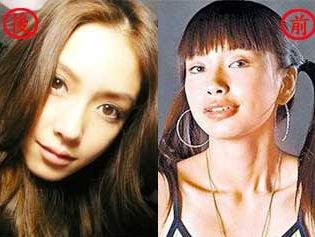 Angelababy Plastic Surgery