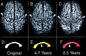 Medical Treatment Pictures-for Better Understanding: Primary Lateral ...