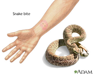 Treatment Adice: Snake Bite First Aid
