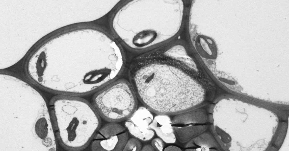 Moss Plants and More: Conducting Cells in Mosses