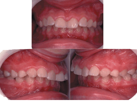 The Daily Floss: Just Flappin' My Gums: Dental Specialties: Orthodontics