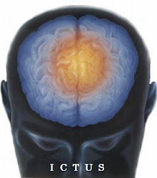 Infartos Cerebrales: Entrada 5: Mapa conceptual sobre Ictus
