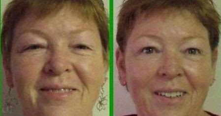 How To Strengthen And Lift Wrinkly, Chunky Cheeks Using Face Toning ...