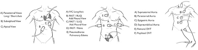 松下 ER ランチ・カンファレンス: POCUS・FAST・RUSH
