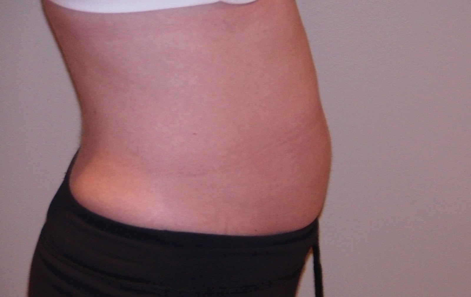 IVF One Day at a Time: 12 week belly pic