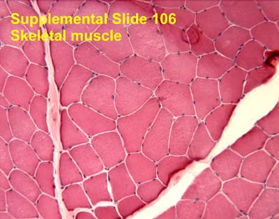 HISTOLOGY PICTURES: Muscle