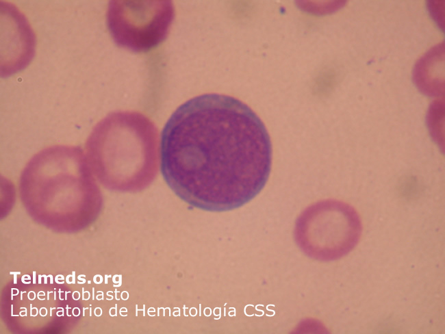 Atlas Hematològico: agosto 2015