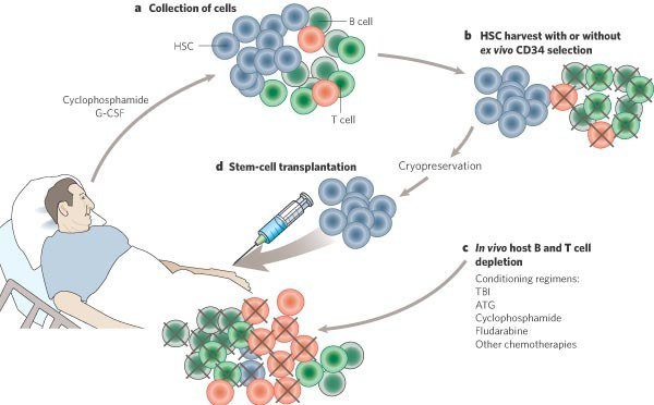 Stem Cells Transplantation - InfoScienceWorld