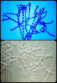 Oekoekpunya.blogspot.com: BTR 3: Mikro Fungi