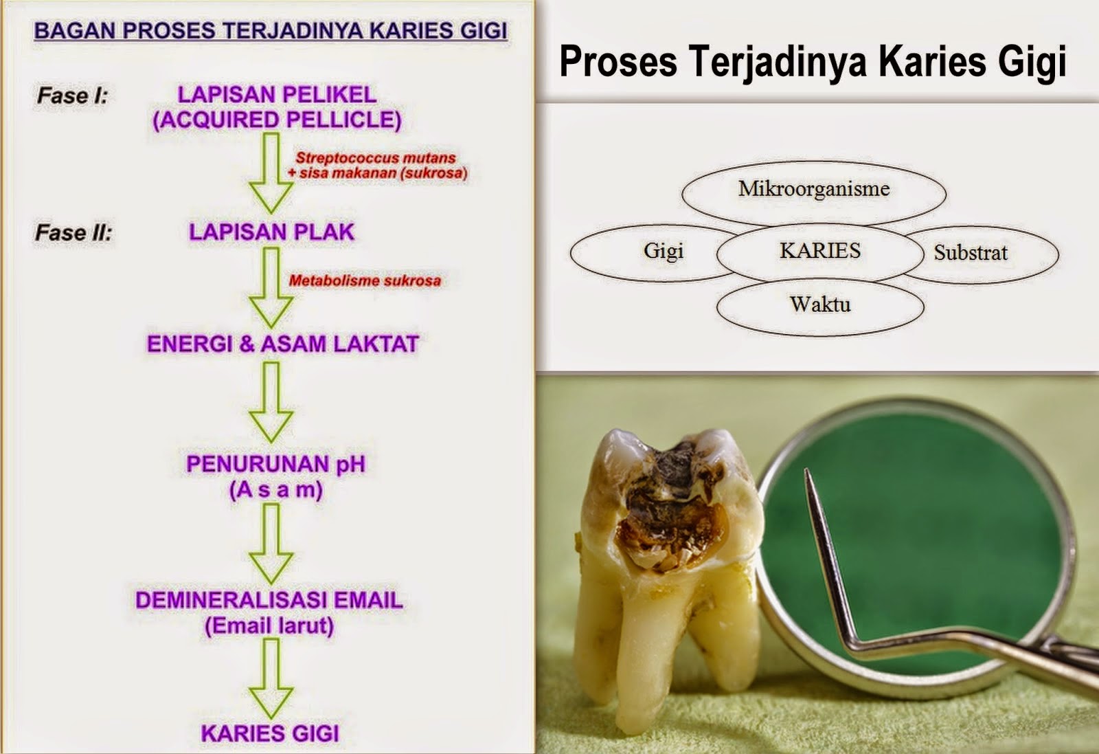 Streptococcus mutans Penyebab Karies Gigi - Biologi Edukasi: Belajar ...