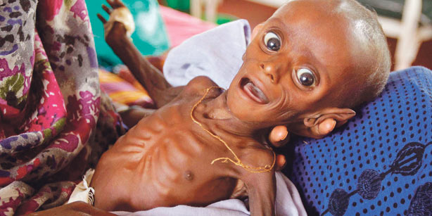 Khabarkini: Kemarau: Ramai Rakyat Somalia Kebuluran