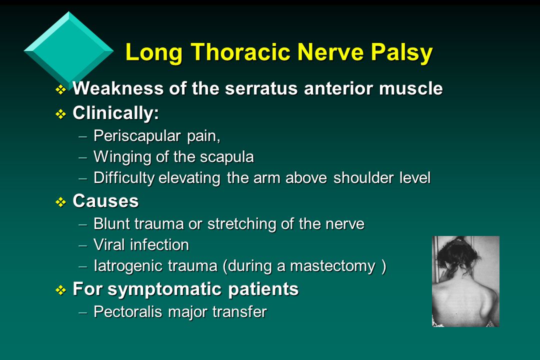 LONG THORACIC NERVE PALSY