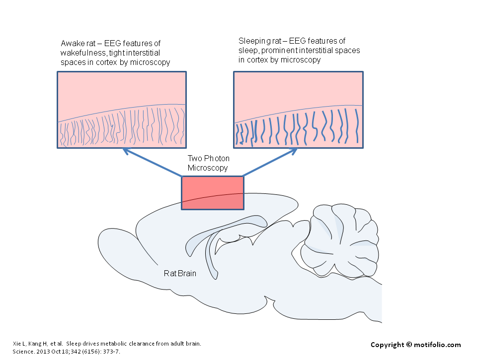 Real Psychiatry: Sleeping Cleans Your Brain