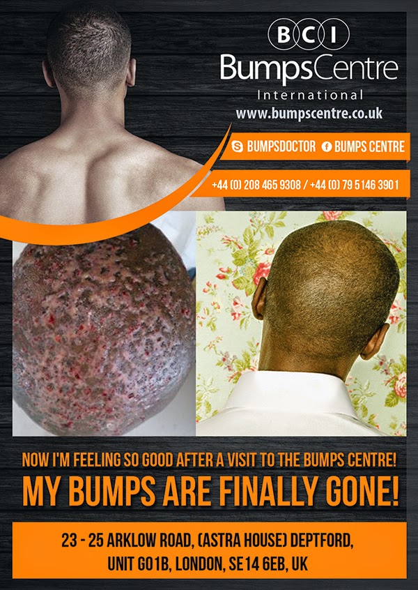Non surgical removal of bump- Bump Centre Limited