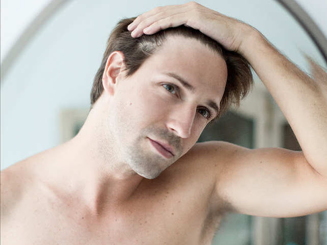 How Can I stop Hair Loss?
