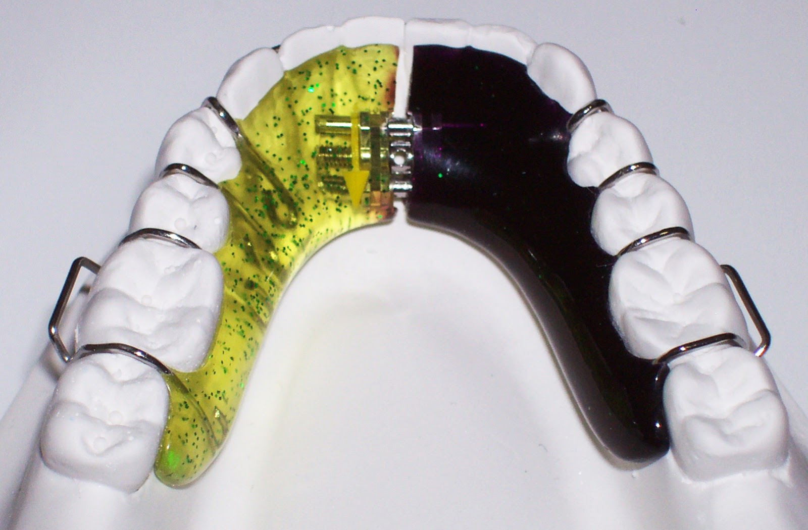 2013-03-31 ~ Медико-техническа ортодонтска лаборатория "Ortho Lab"