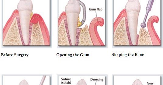 Best Top Smile Designing makeover enhancement Dentist Dental Clinic in ...