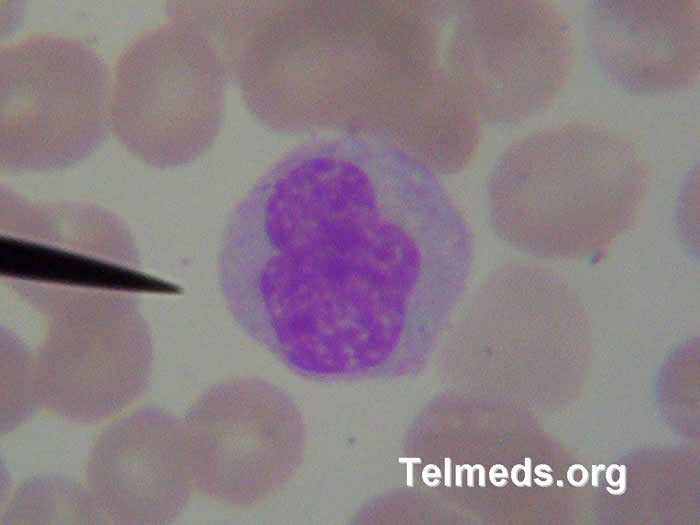 Hematología: Leucopoyesis
