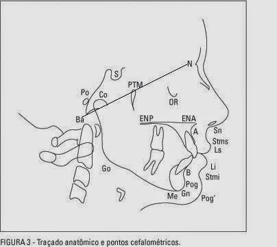 Muito bom esse café !: Anatomia - O Crânio (vista anterior e superior)