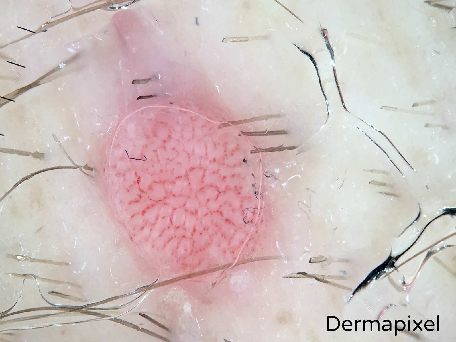 Dermapixel: agosto 2017