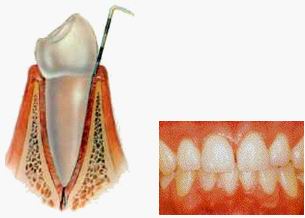 Estomatología Integral III: LA ENCÍA