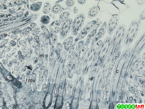 [Microbiology] Atlas of Mycoplasma and Ureaplasma | Free Medical Atlas