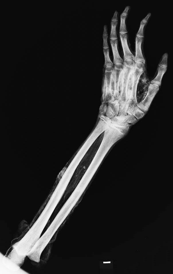 Guardian of the Artifacts: The Antietam Arm on Display