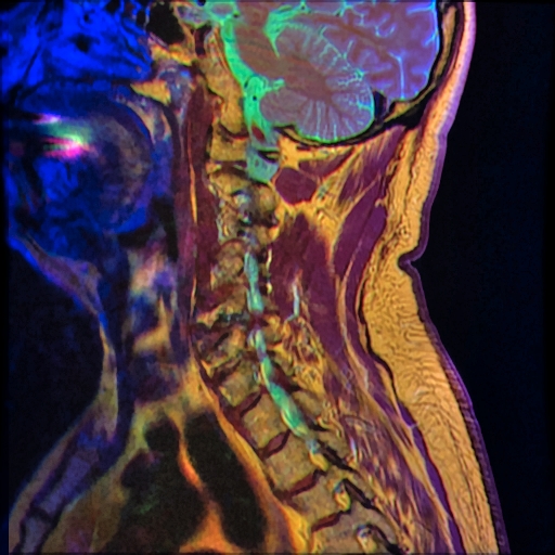 Nevit's blog: Color MRI of the Cervical verterbrae