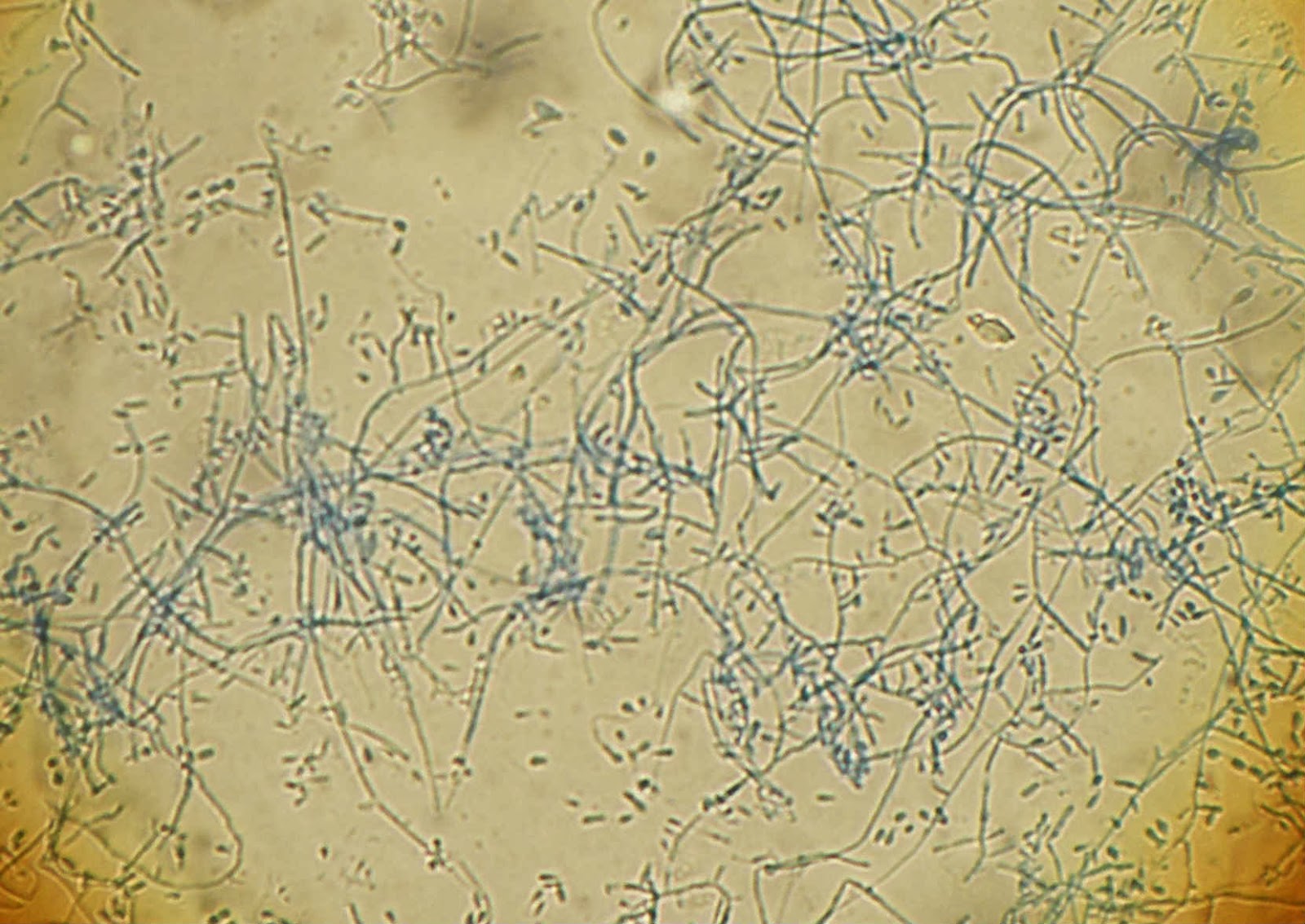 ATLAS MICOLOGIA: TRICHOPHYTON RUBRUM - 2 NOVAS ESTIRPES
