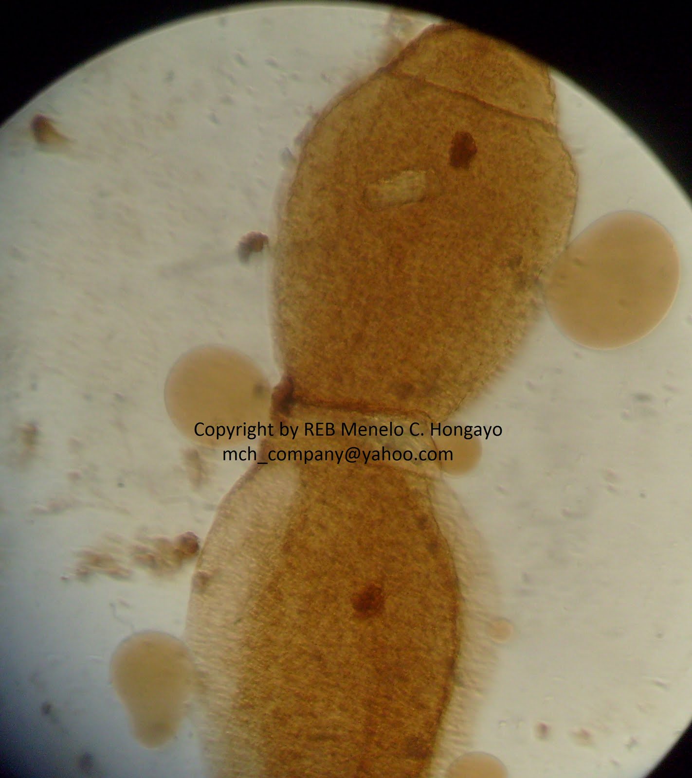 MCH unlimited for Science: Gregarina sp