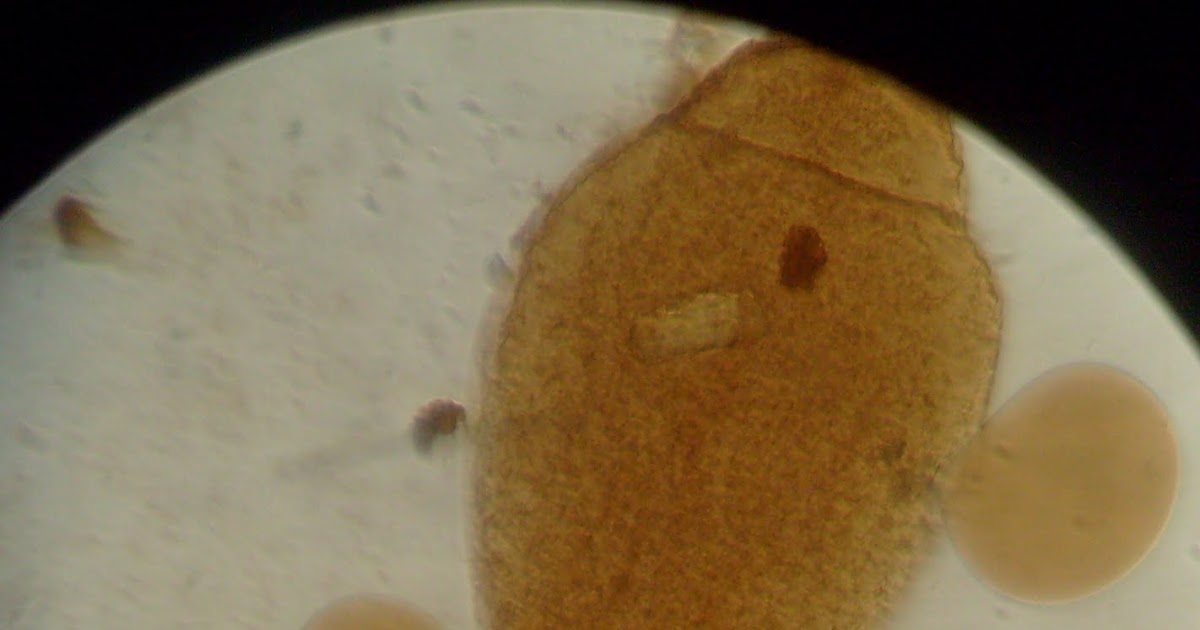 MCH unlimited for Science: Gregarina sp