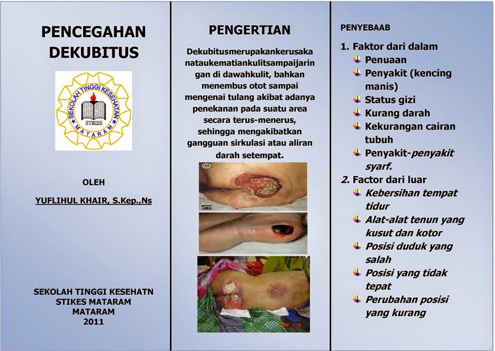 LEAFLET PENCEGAHAN DEKUBITUS - EBOOK YUFLIHUL KHAIR