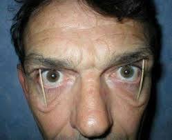 7 Manusia yang mempunyai kebolehan luarbiasa - Info Viral