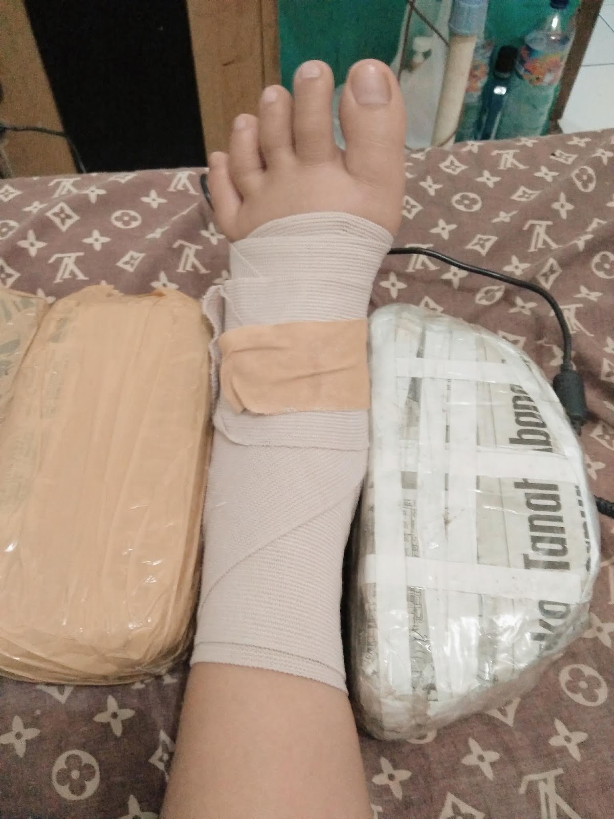 Biaya pengobatan cedera engkel (sprain ankle) MAHAL!!! - Untold Story