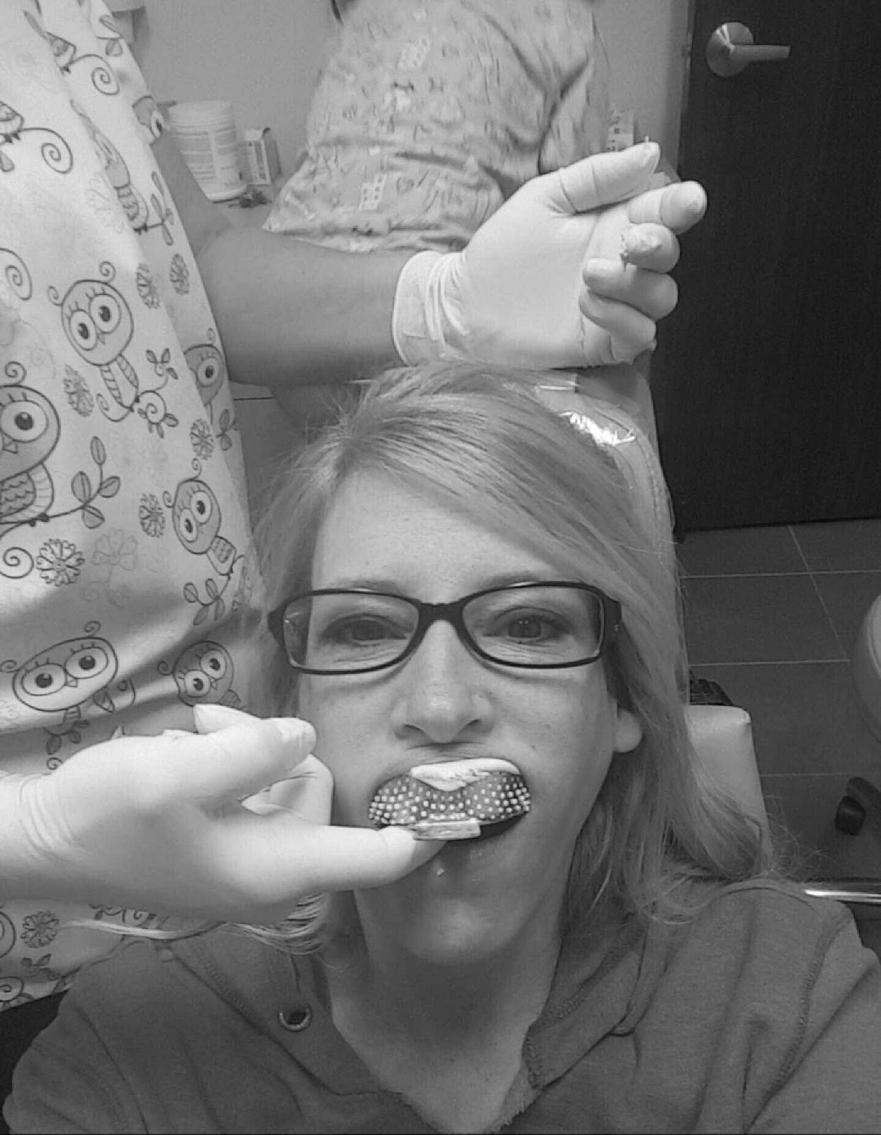 Adult Braces - My Journey