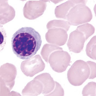 Polychromatophilic Normoblast ~ Hematology Lectures