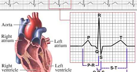 Makalah EKG (elektrokardiogram) Full ~ BelajarEKG