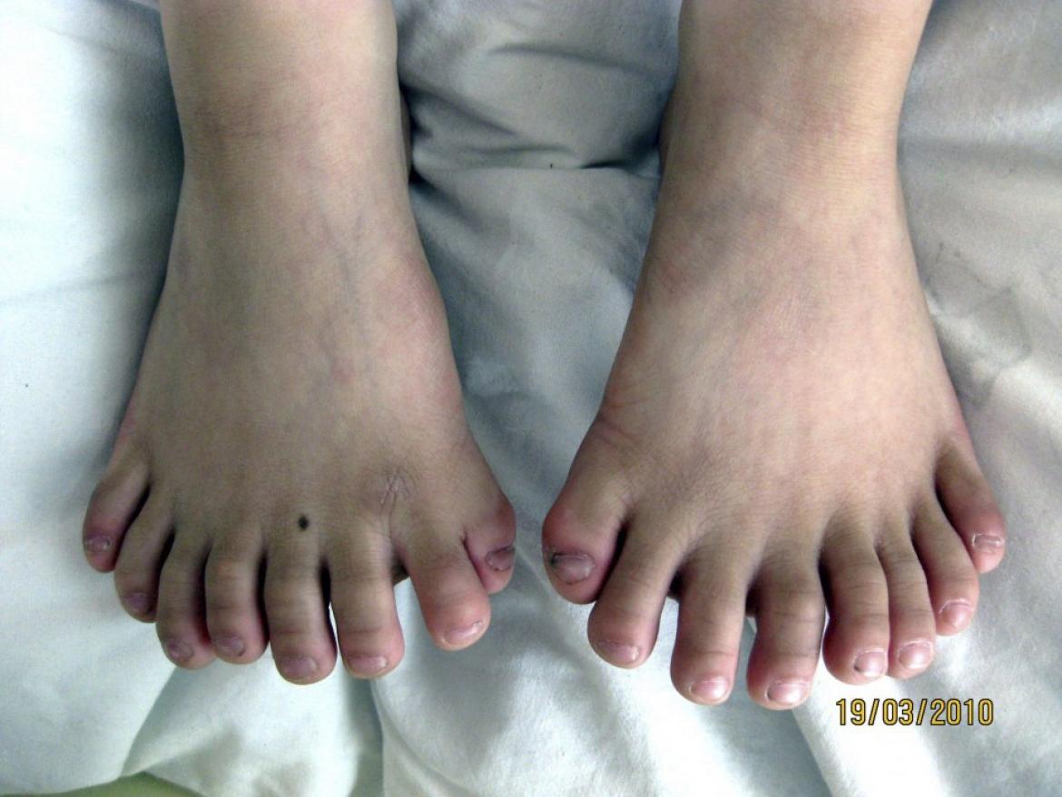 Mutations and Monsters