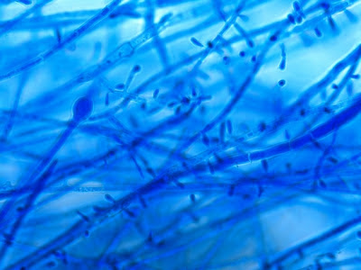 Fun With Microbiology (What's Buggin' You?): Trichophyton tonsurans