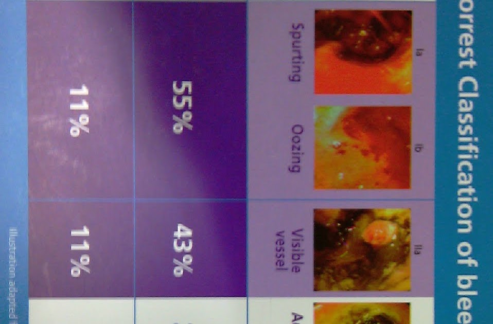 medical K.I.S.S: Forrest classification