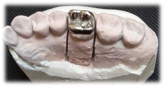 Materiales Odontológicos