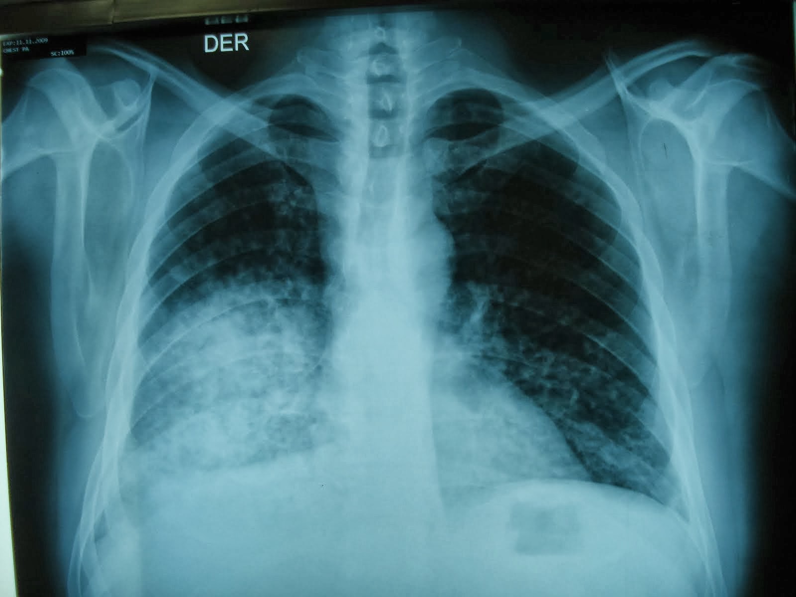 Estudiante de Medicina: septiembre 2013