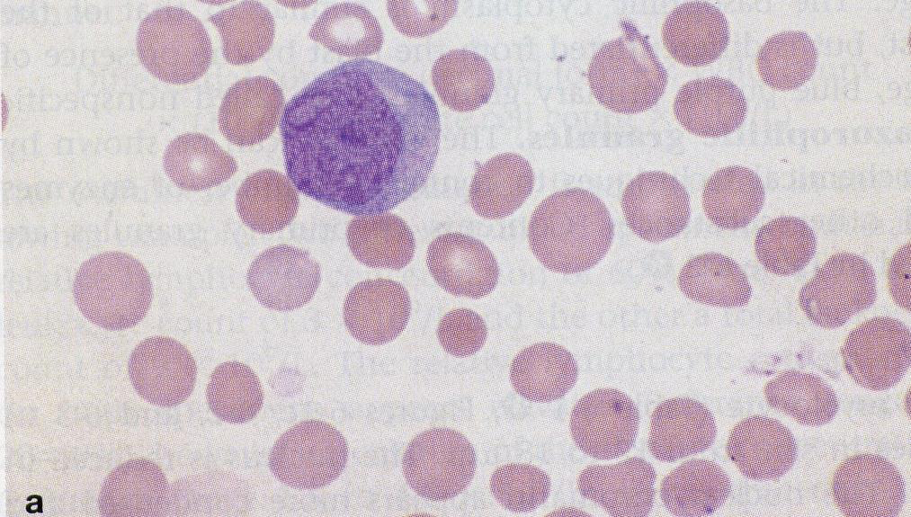 células sanguineas: Fichero de Hematología