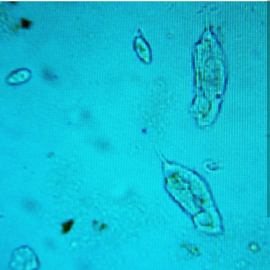 Michele's Microscopy: Euchlanis Dilatata /Colpidium Colpoda