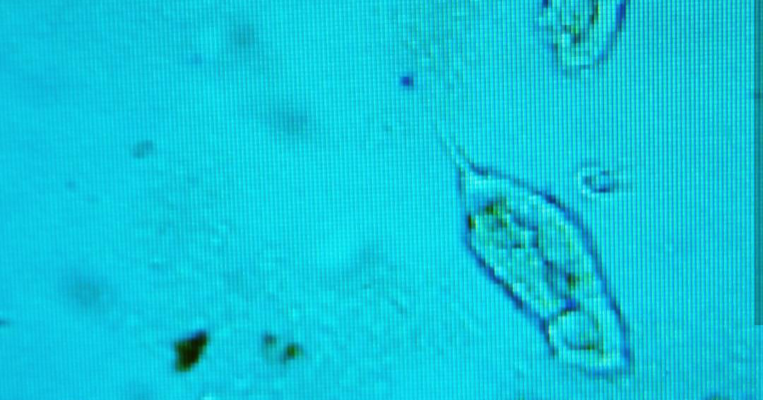 Michele's Microscopy: Euchlanis Dilatata /Colpidium Colpoda