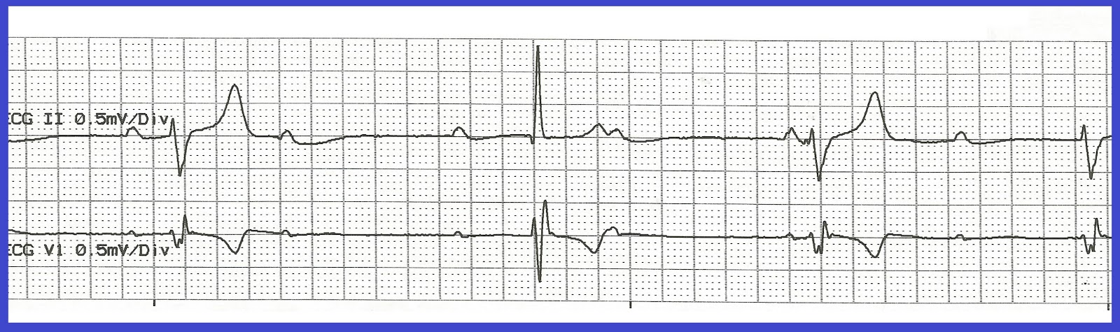 Practice EKG Rhythm Strips 168