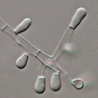 Trichophyton tonsurans